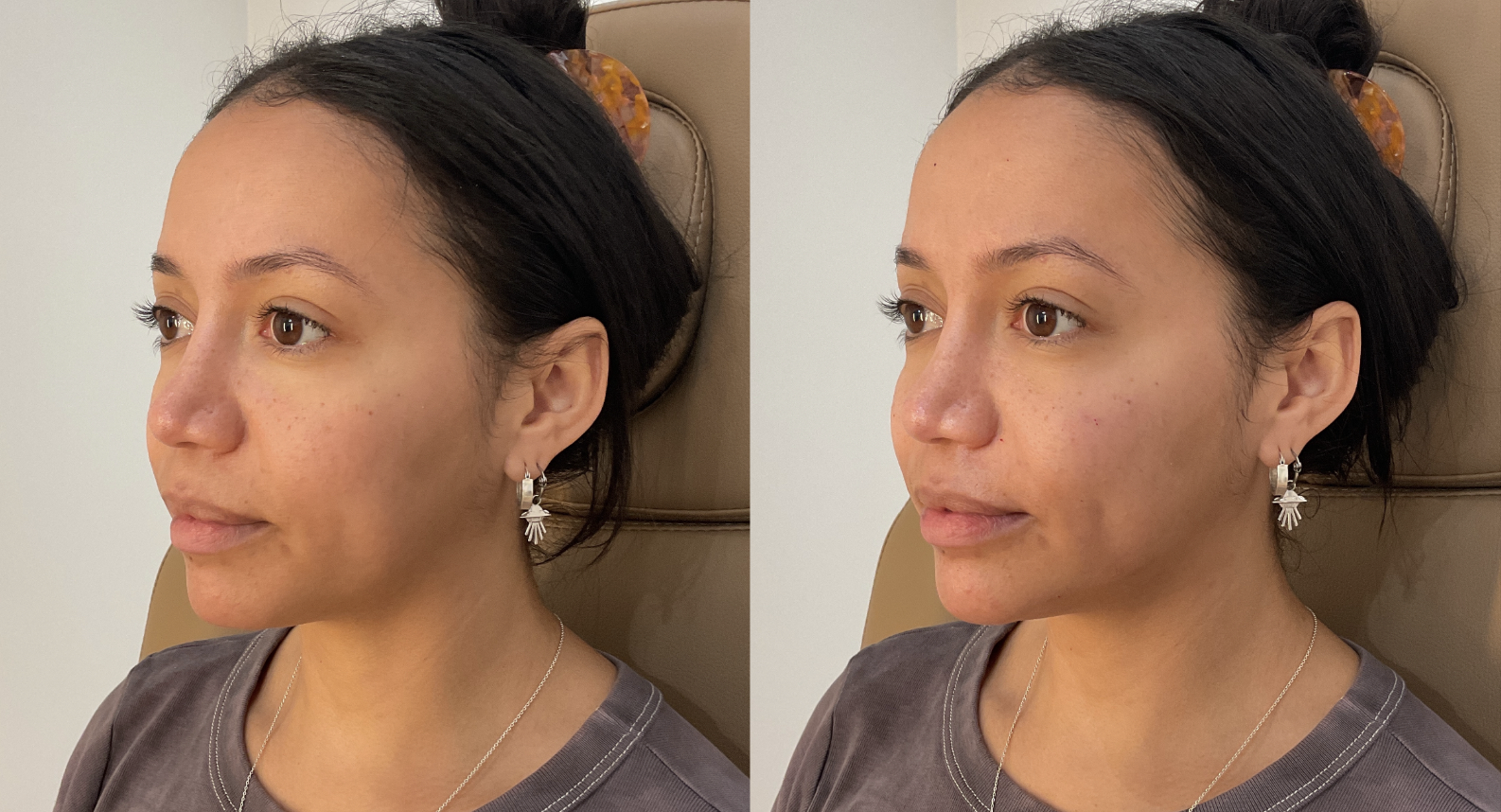 JECT - Medical Aesthetics Made Modern - NYC, LA & Miami