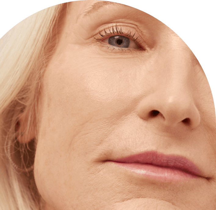 Moxi Laser Treatment - Laser Resurfacing | JECT